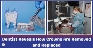 Dentist Reveals How Crowns Are Removed and Replaced